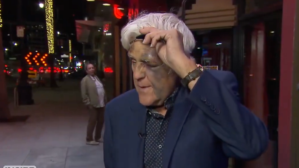 Jay Leno Bruised, Breaks Wrist in 60-Foot Fall Down Hill